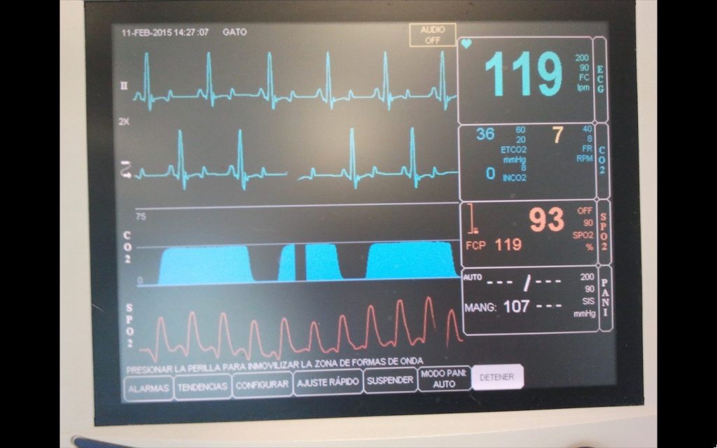 Principios de anestesia | Blog Jordi Gimeno